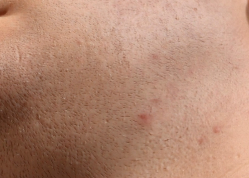 Jaw dropping REALTIME! human skin SSS demo | Renderosity